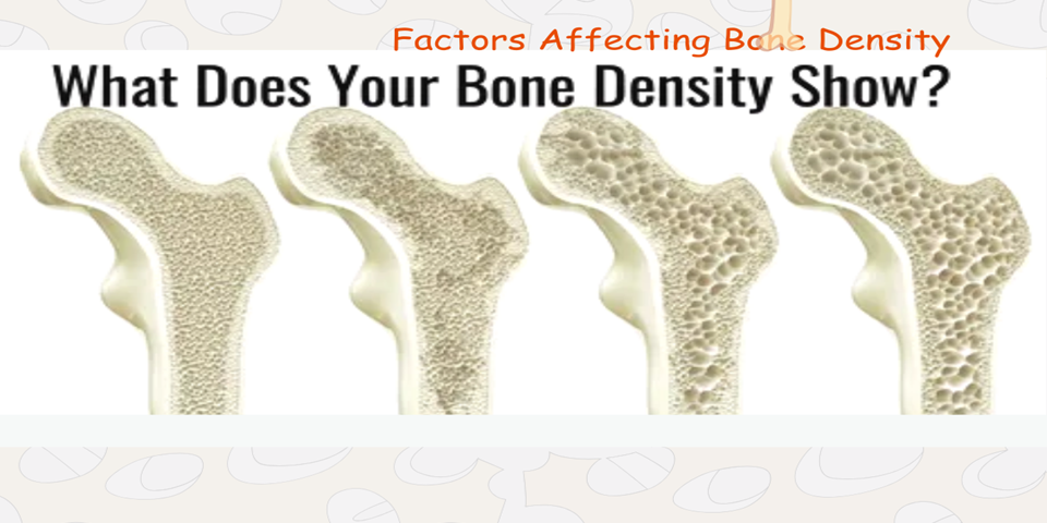 Bone Density and Its Importance - Dr. Ramprasad Dharangutti